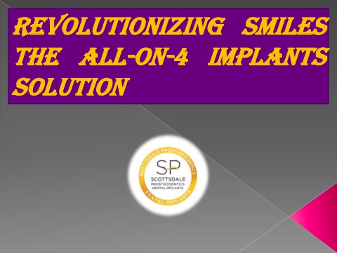 Revolutionizing Smiles The All-on-4 Implants Solution - drdeviusa Flip ...