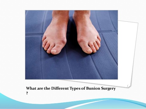 What are the Different Types of Bunion Surgery ? - Dr Tan Ken Jin ...