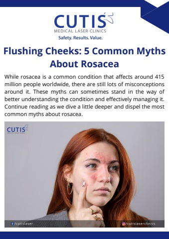 Flushing Cheeks: 5 Common Myths About Rosacea - Cutis Medical Laser ...