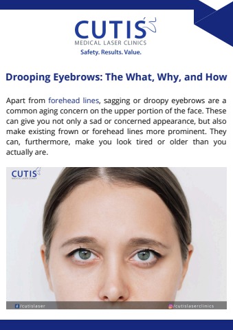 Drooping Eyebrows: The What, Why, and How