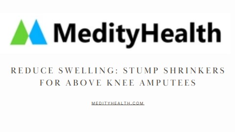 Stump Shrinkers for Above Knee Amputees to Reduce Swelling - Medity ...
