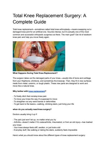Total Knee Replacement Surgery_ A Complete Guide