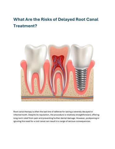 What Are the Risks of Delayed Root Canal Treatment