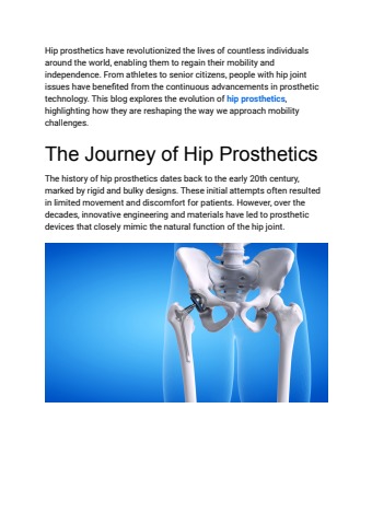 Hip Prosthetics: An In-Depth Look at Advanced Materials and Types ...