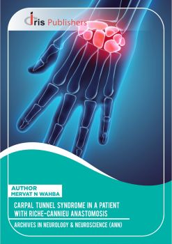 Carpal Tunnel Syndrome in a patient with Riche- Cannieu Anastomosis ...