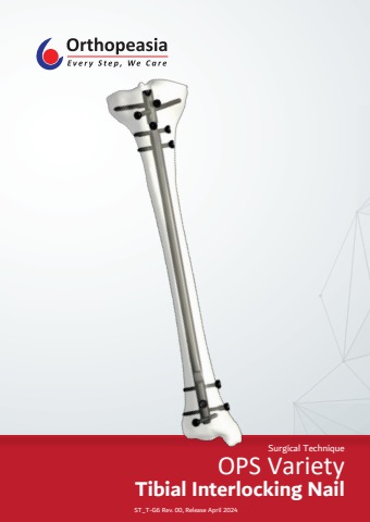 OPS Variety Tibial Interlocking Nail - Orthopeasia Co., Ltd. Flip PDF | AnyFlip