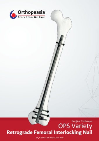 OPS Variety Retrograde Femoral Interlocking Nail - Orthopeasia Co., Ltd ...
